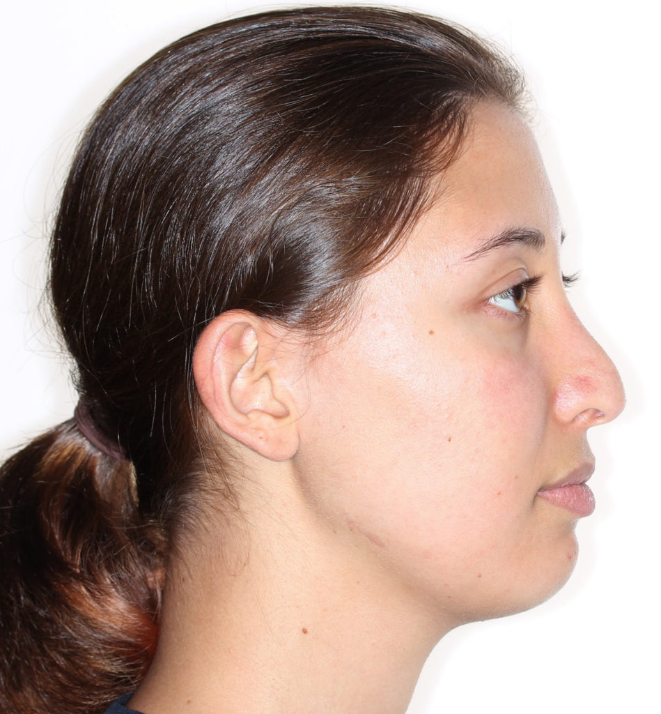 Treatment Photos « Roncone Orthodontics International