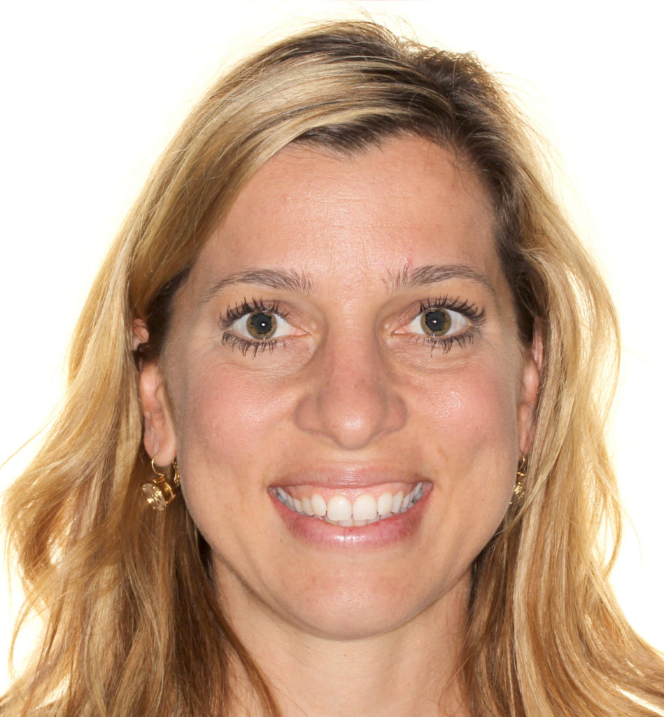 Treatment Photos « Roncone Orthodontics International