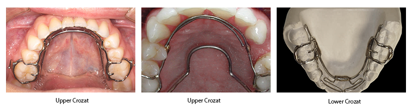 crozats « Roncone Orthodontics International