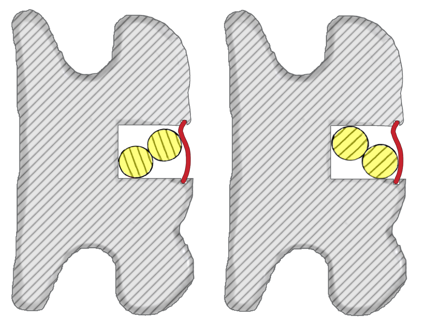 The PDS Wires « Roncone Orthodontics International